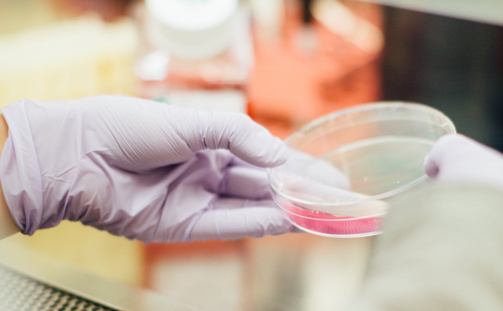 SFM - Société Française de Microbiologie