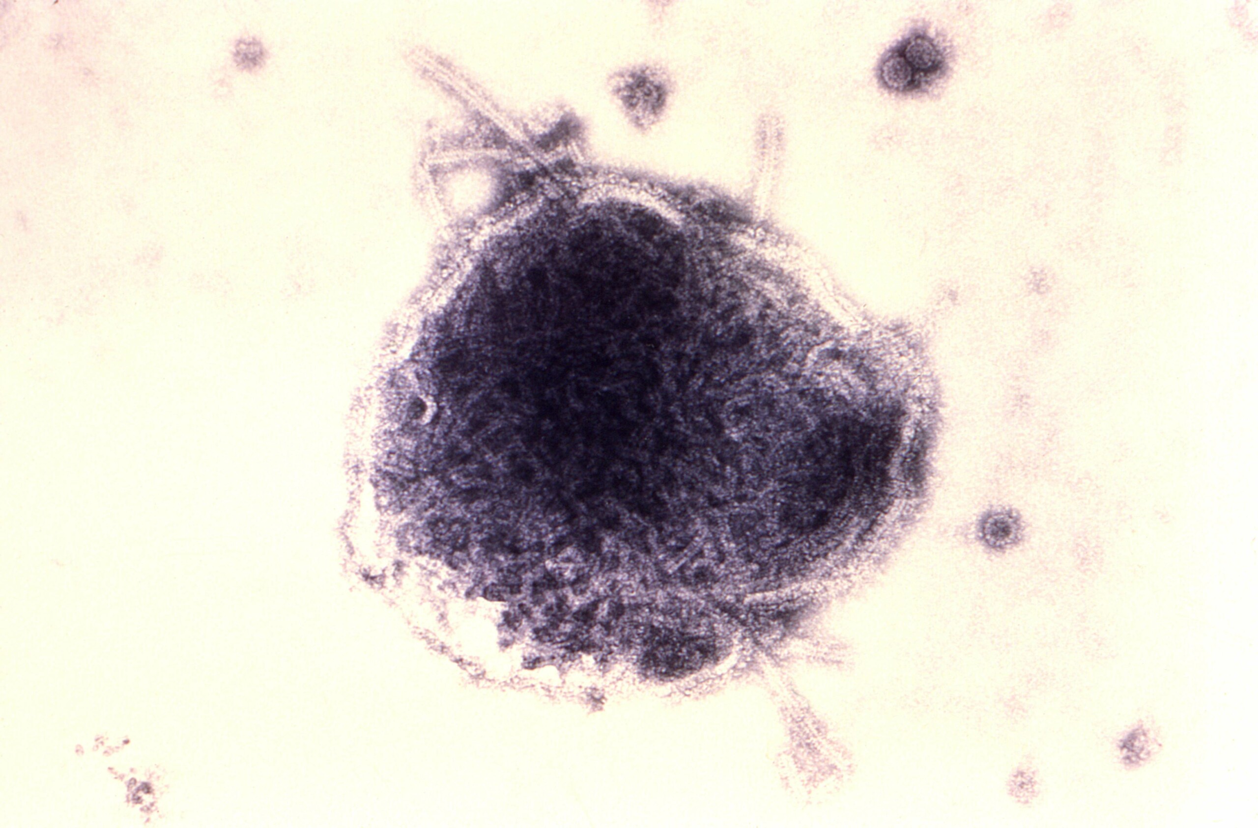 Points clés sur la rougeole - Société Française de Microbiologie