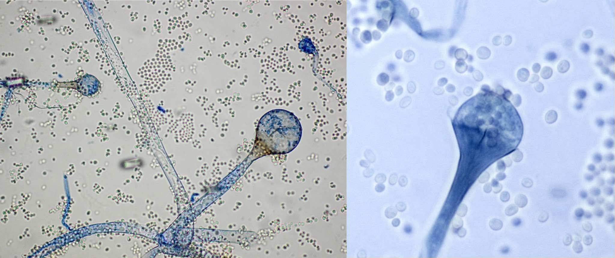 Champignon du mois - Novembre 2020 - Société Française de Microbiologie