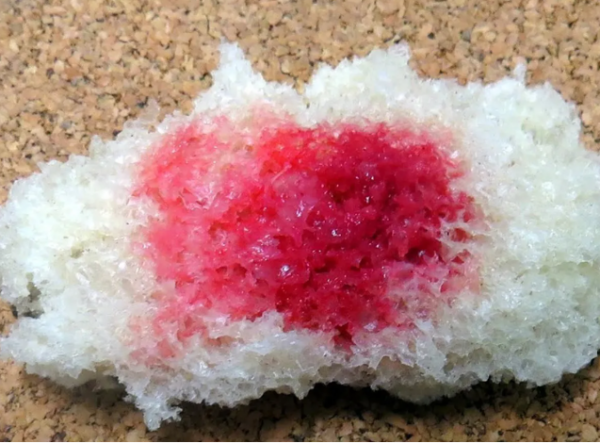 Serratia marcescens, une bactérie qui fait des miracles - Société ...